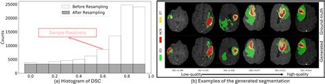 [논문 리뷰] Qcresunet Joint Subject Level And Voxel Level Segmentation Quality Prediction