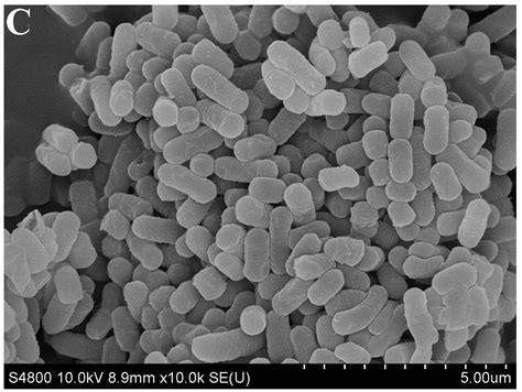 Screening of Lactiplantibacillus plantarum 67 with Strong Adhesion to ...