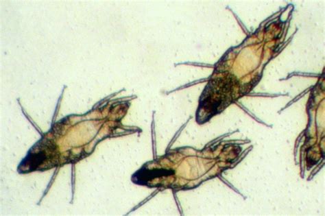 Invisible Bugs In My Bed