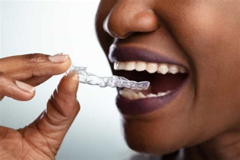Byte Aligners Review Must Read This Before Buying