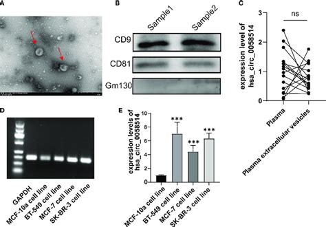 The Detection Of Evs In Bc Patients A Evs With A Diameter Of 100 500 Download Scientific