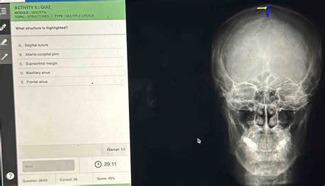 Solved Activity 1 Quiz Module Skeletal Topic Structures Type Multiple Choice What
