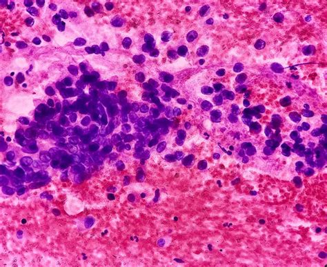 10400개 이상의 병리학자 이미지 스톡 사진 그림 및 Royalty Free 이미지 Istock