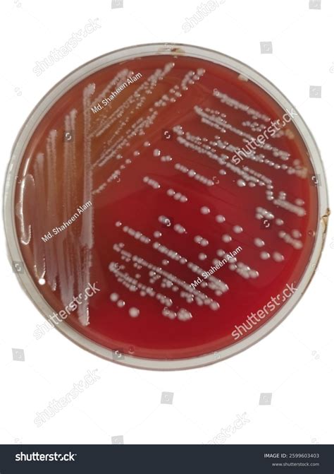 Klebsiella Sheep Blood Agar String Test Stretching Colonies Form A
