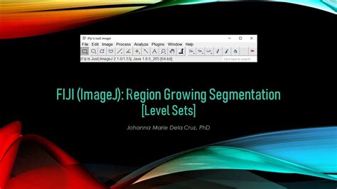 Fiji Imagej Region Growing Segmentation Level Sets Youtube