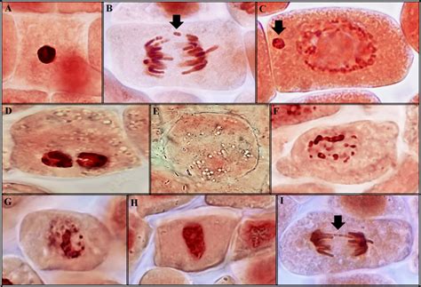 Chromosomal Abnormalities Found In The Mitotic Process Of P Sativum