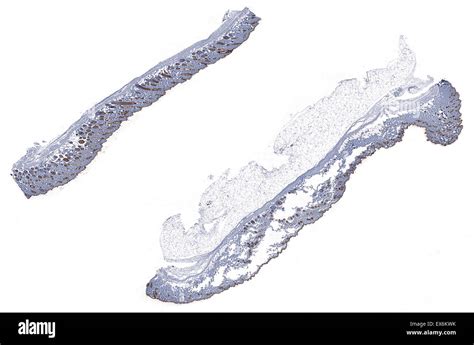 Cytokeratin Wide Spectrum Immunoperoxidase Staining Of Formalin Fixed Paraffin Embedded Mouse