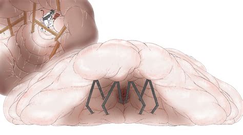 Rule 34 Blob Blowjob Face Fat Futanari Gabbadraws Hyper Ass Hyper Belly Mizuki Gabbadraws