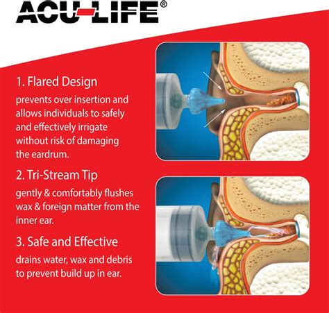Acu Life® Ear Irrigator With Soft Tri Steam Fit Includes Basin Ear S
