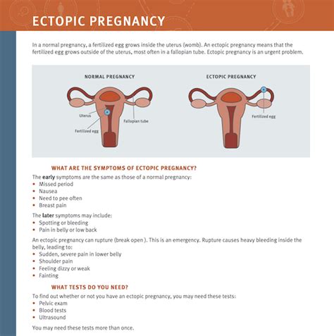 Reproductive Health Access Project Rhap Treating Ectopic Pregnancy
