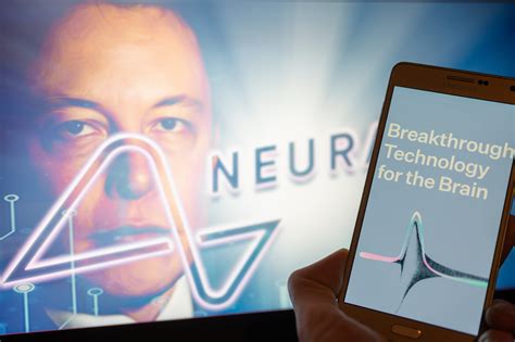 Elon Musks Neuralink Brain Chip Startup Gains Approval For Human Trial