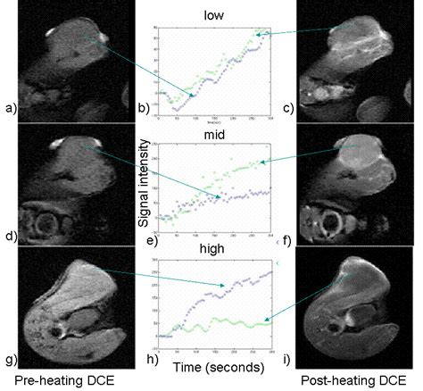 Dynamic Contrast Enhanced Images Acquired Before And After Each Heating