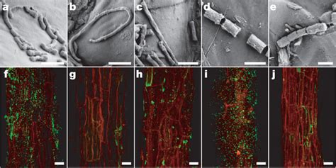 Arabidopsis Root Inhabiting Bacteria Are Detectable On The Rhizoplane Download Scientific