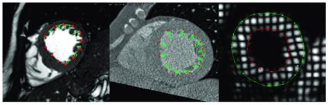 Assessment Of GCS In The Same Subject From The Mid Ventricular Download Scientific Diagram