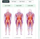 Full Body DEXA Scan In Los Angeles CA BodySpec