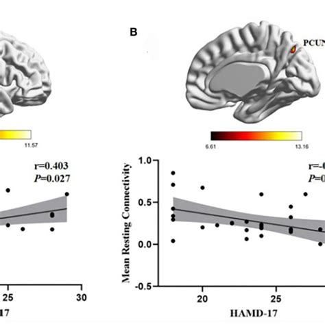 Figure Brain Regions With Abnormal Fc Of The Ccn Among The Three Groups
