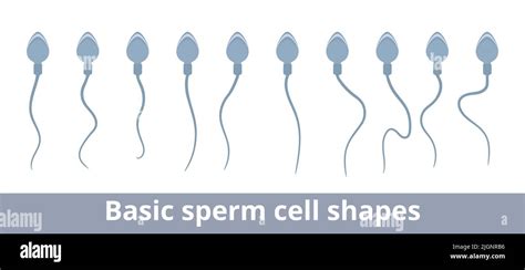 Basic Sperm Cell Shapes Visualization Of A Normal Sperm Cell With An Oval Head And A Long Tail