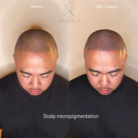 Scalp Micropigmentation Sway Inked Studio