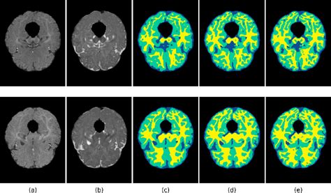 Figure 2 From 3d Densely Convolutional Networks For Volumetric