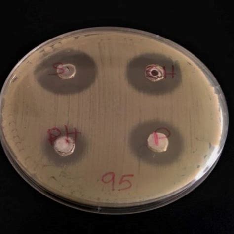 Agar Diffusion Method Showed The Antibacterial Activity Of Different Download Scientific