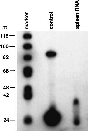 Determination Of Human Dpp I Gene Transcription Initiation Site By Download Scientific Diagram