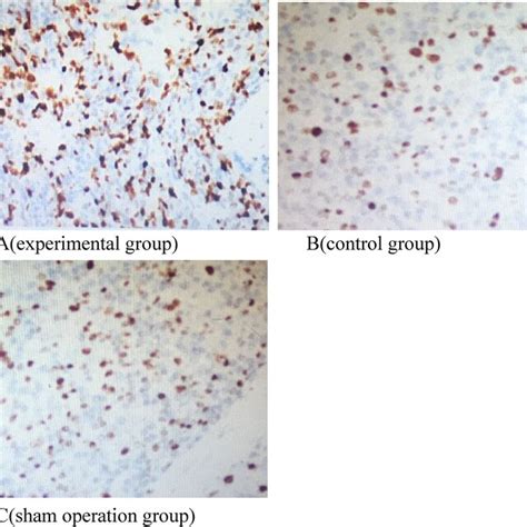 Analysis Of Ntcp Expression By Immunohistochemical Assay A Ntcp