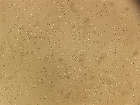 Acinetobacter Baumannii Introduction Morphology Pathogenicity