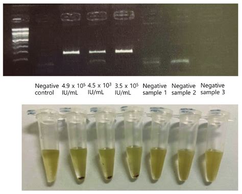 Representative Results Of The Stat Dna Using Clinical Samples The Download Scientific Diagram