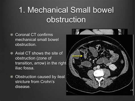 Approach To Pfa Interpretation Pptx