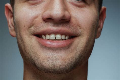 What Is Diastema Gap Between The Teeth Explained