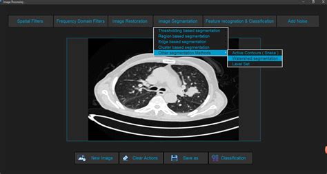 github ayazaky mri based brain tumor classification desktop