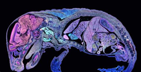 Discovering Spatial Transcriptomics With 10x Xenium Bia Separations Cro