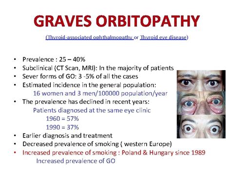 How To Treat Hyperthyroidism When Go Is Present