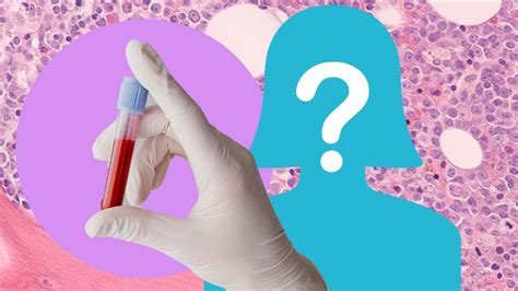 ¿qué Es La Leucemia Enfermedad Que Terminó Con La Vida De Esta Actriz