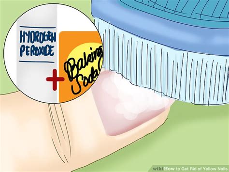 How To Get Rid Of Yellow Nails 11 Steps With Pictures WikiHow