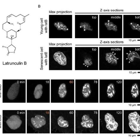 Examples Of Nuclear F Actin Dynamics Upon Latb Treatment A Merging