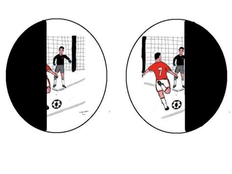 Inferior Temporal Visual Field Defect