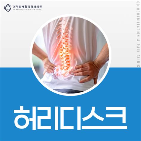 괴정정형외과 찌르는 듯한 허리 통증의 원인은 허리디스크 네이버 블로그