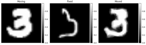 分割图SynthMorph零样本学习完成跨模态配准任务 知乎