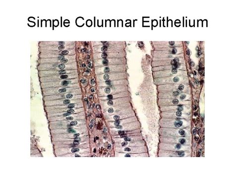 Simple Squamous Epithelium Simple Cuboidal Epithelium Simple Columnar