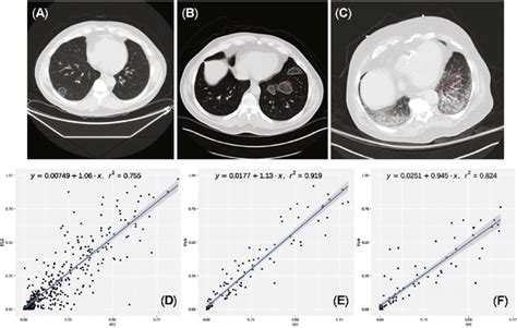 Results Of The Ct Segmentation Network A B C Three Segmentation Download Scientific Diagram