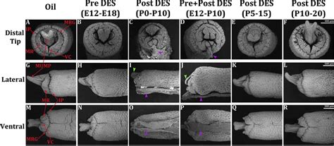 Scanning Electron Micrographs Of Adult Day Mouse Penises Treated Download Scientific