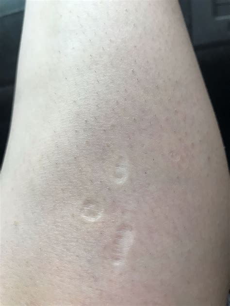 Sex Trafficking Pipeline Runs Through Cobb Local News Sex Trafficking Pipeline Runs Through Cobb Local News