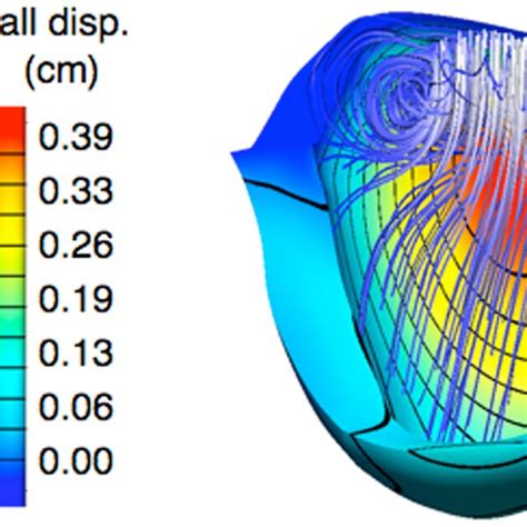 Example Of Results From Fluid Structure Interaction Fsi Simulations Download Scientific