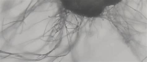 Lions Mane Mycelium On Agar Under The Microscope X100 Ragarporn