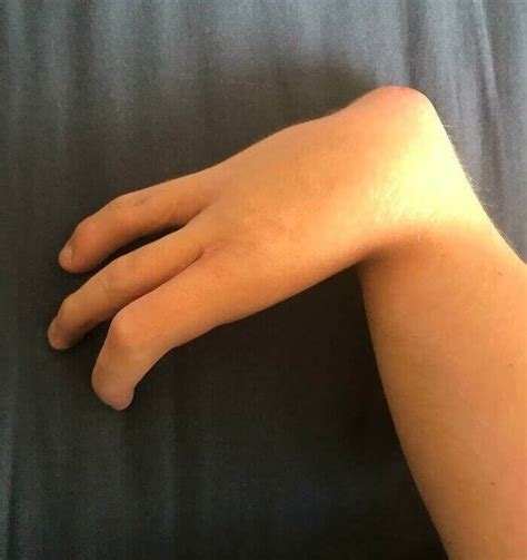 These People S Genetic Conditions Really Make Them Unique Artofit