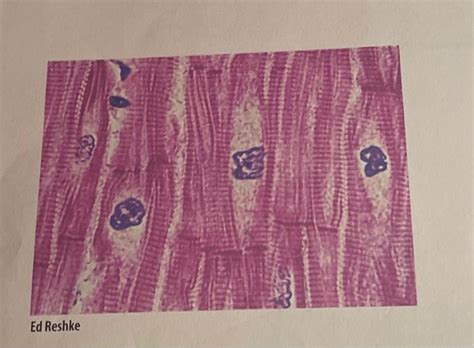 Solved Label All Parts