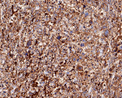 Hla Dp Recombinant Monoclonal Antibody Pd00 70 Ma5 50758