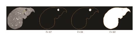 Comparison Of Confidence Connected Segmentation Results Under Different Download Scientific