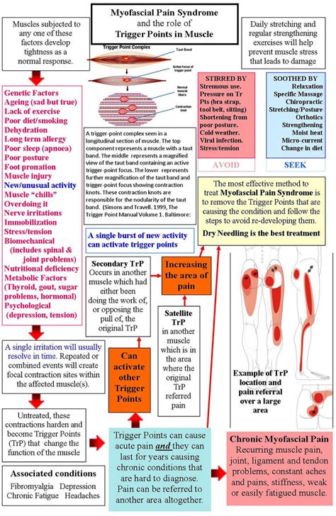 Trigger Point Dry Needling Chart Dr Peter Pedersen Gold Coast